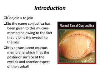 Anatomy of the conjunctiva | PPTX