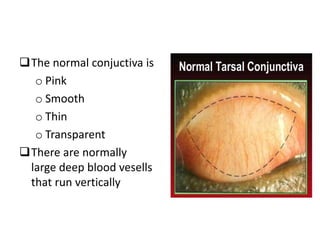 Anatomy of the conjunctiva | PPTX