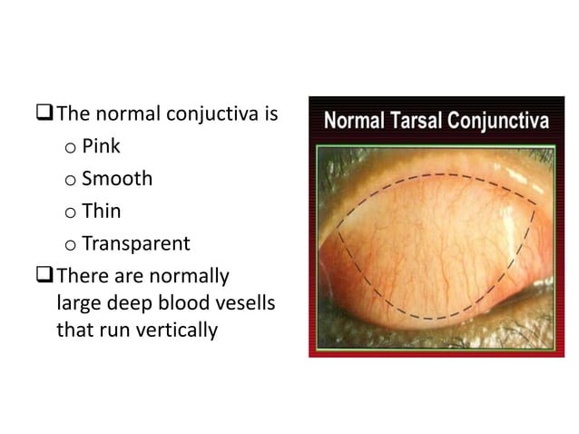 Anatomy of the conjunctiva | PPTX