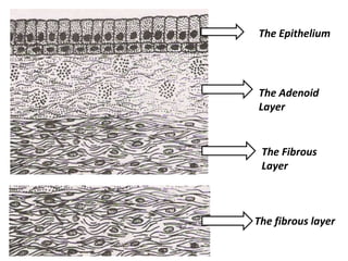 Bulbar Conjunctiva Histology