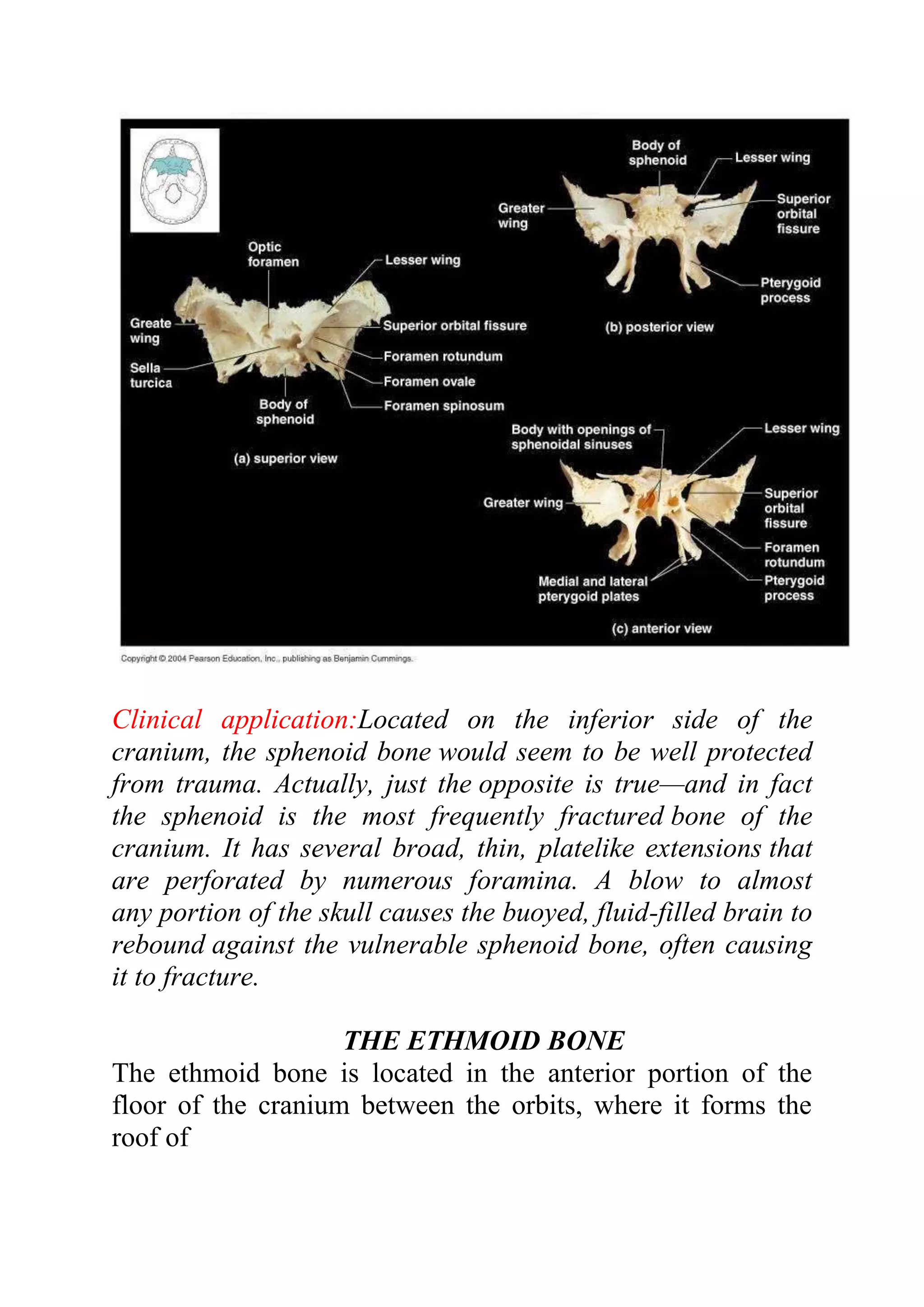 Anatomy of the cranial bones | DOCX