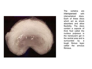 Anatomy of the Disc | PPT