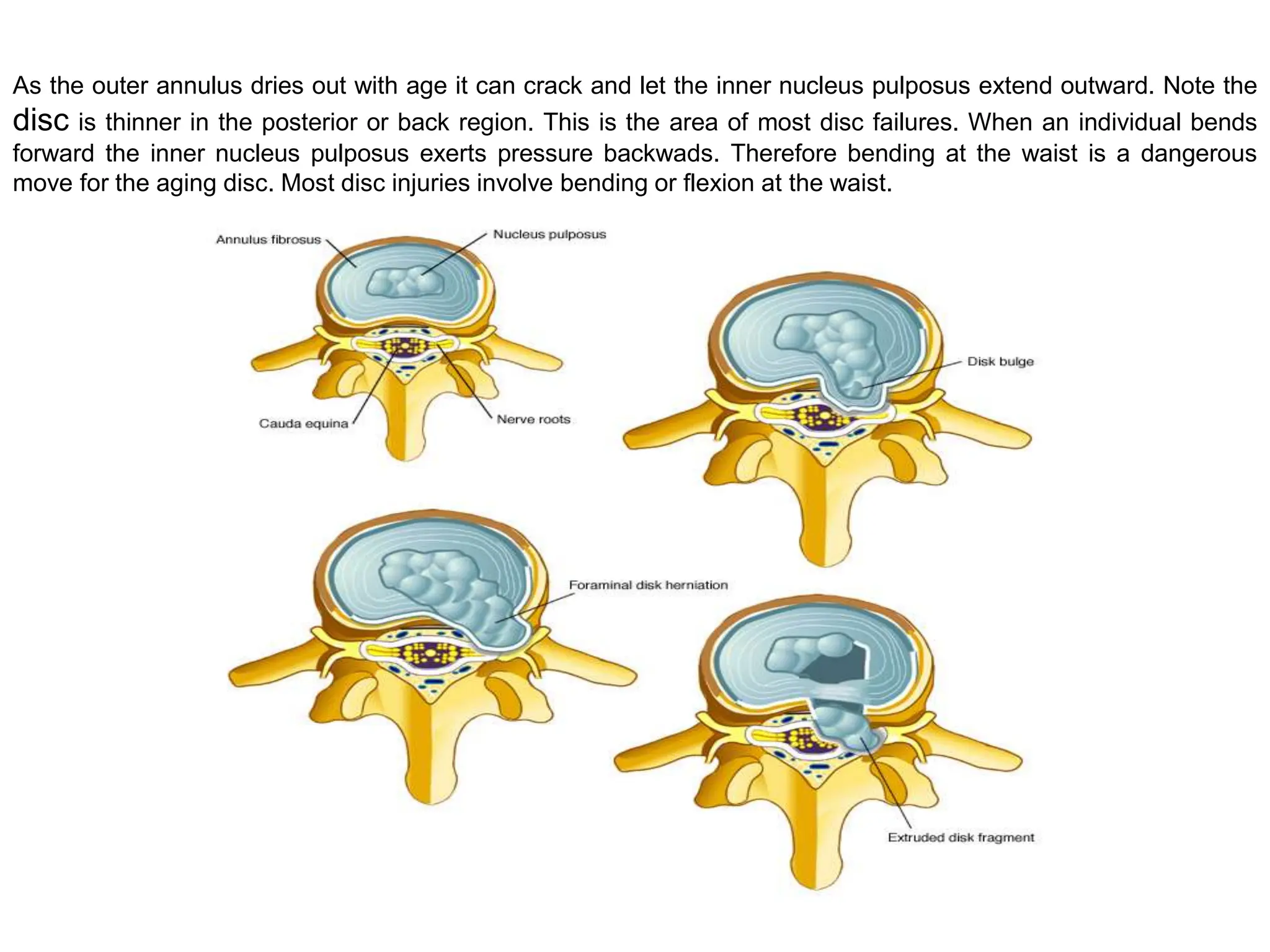 anatomy of the disc in spine anatomy complete | PPT