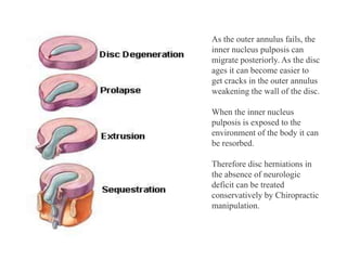 anatomy of the disc in spine anatomy complete | PPT