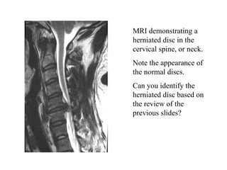 anatomy of the spinal disc - cervical .ppt