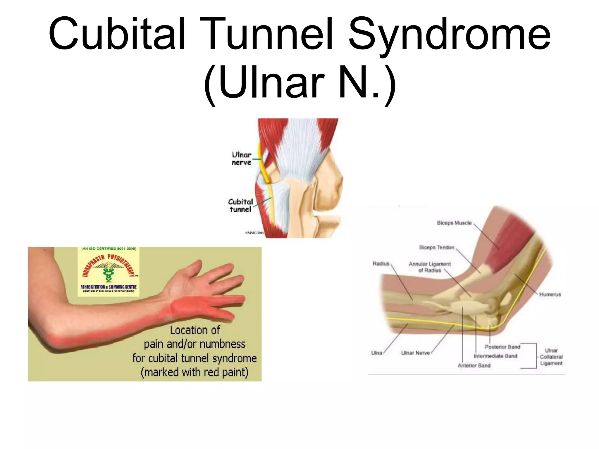 Anatomy of the elbow region | PPTX