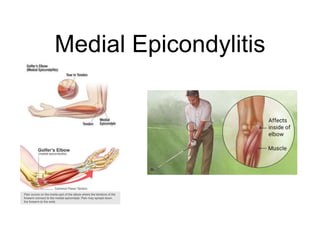 Anatomy of the elbow region | PPTX