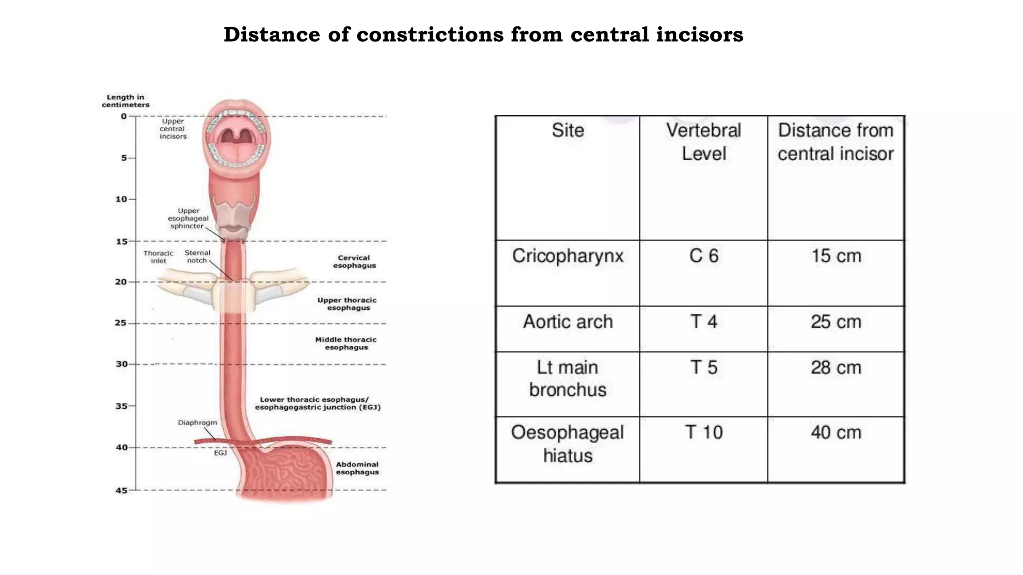 Anatomy of the esophagus.pptx