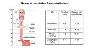 Anatomy of the esophagus.pptx