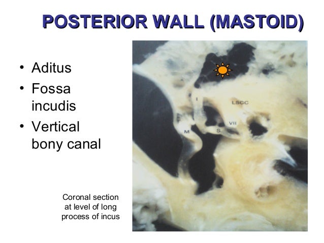 Anatomy of the external and middle ear