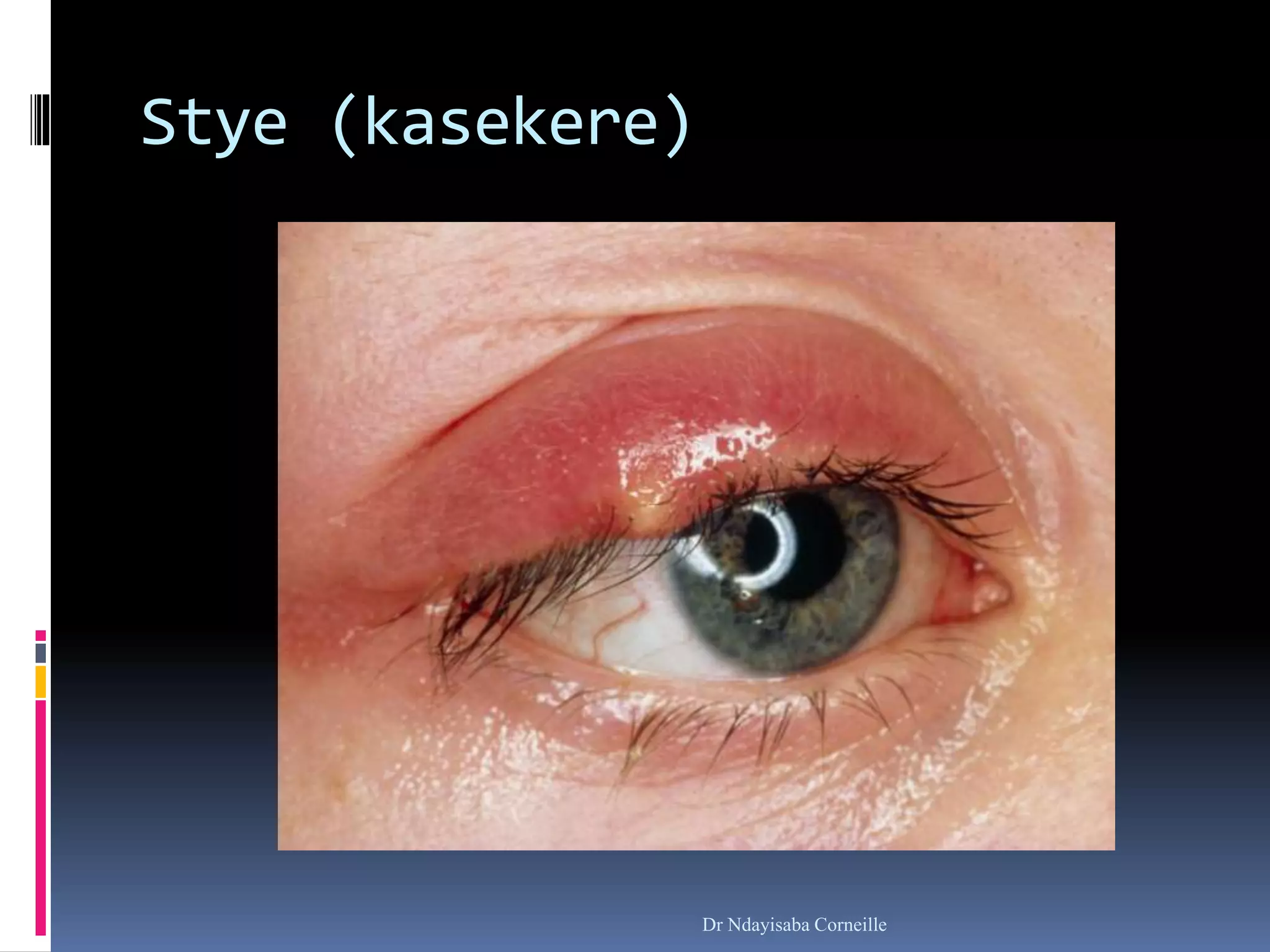 ANATOMY_OF_THE_EYE_AND_ORBITS.ppt