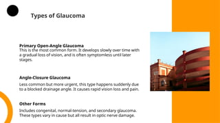 Anatomy of the Eye & Glaucoma Training.pptx