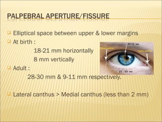 Palpebral Aperture