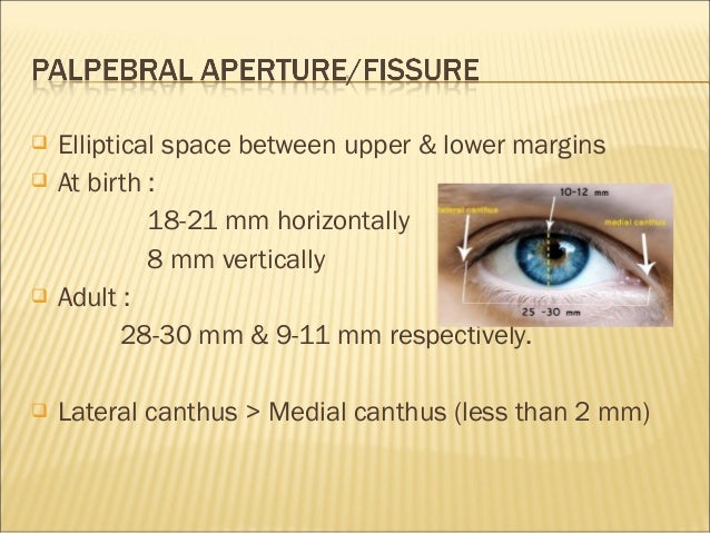Medial And Lateral Apertures