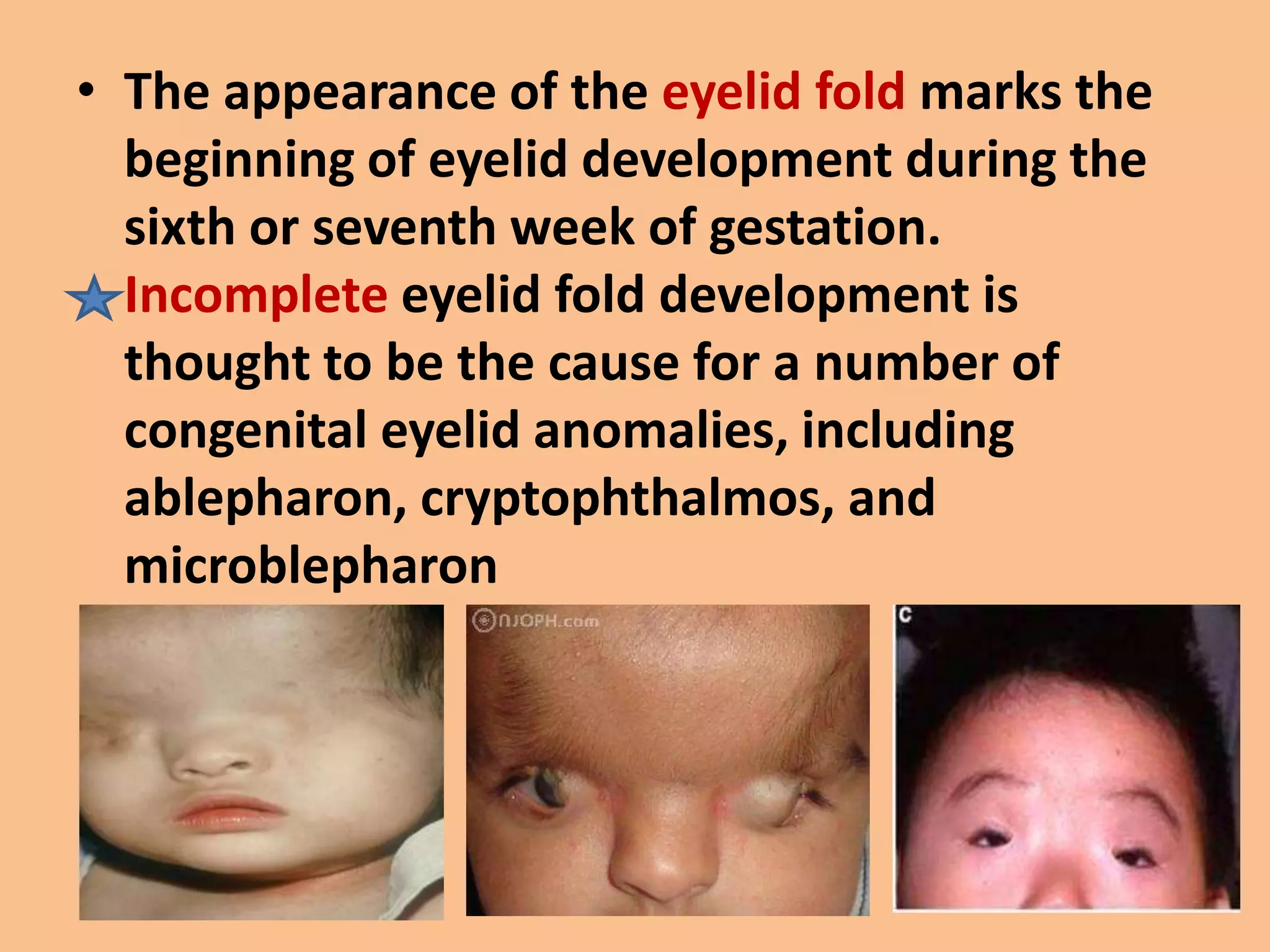 Anatomy of the eyelids | PPTX