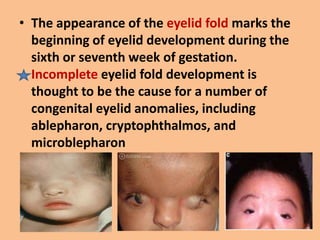 Anatomy of the eyelids | PPTX