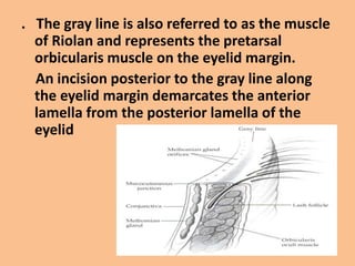 Eyelid Anatomy Grey Line