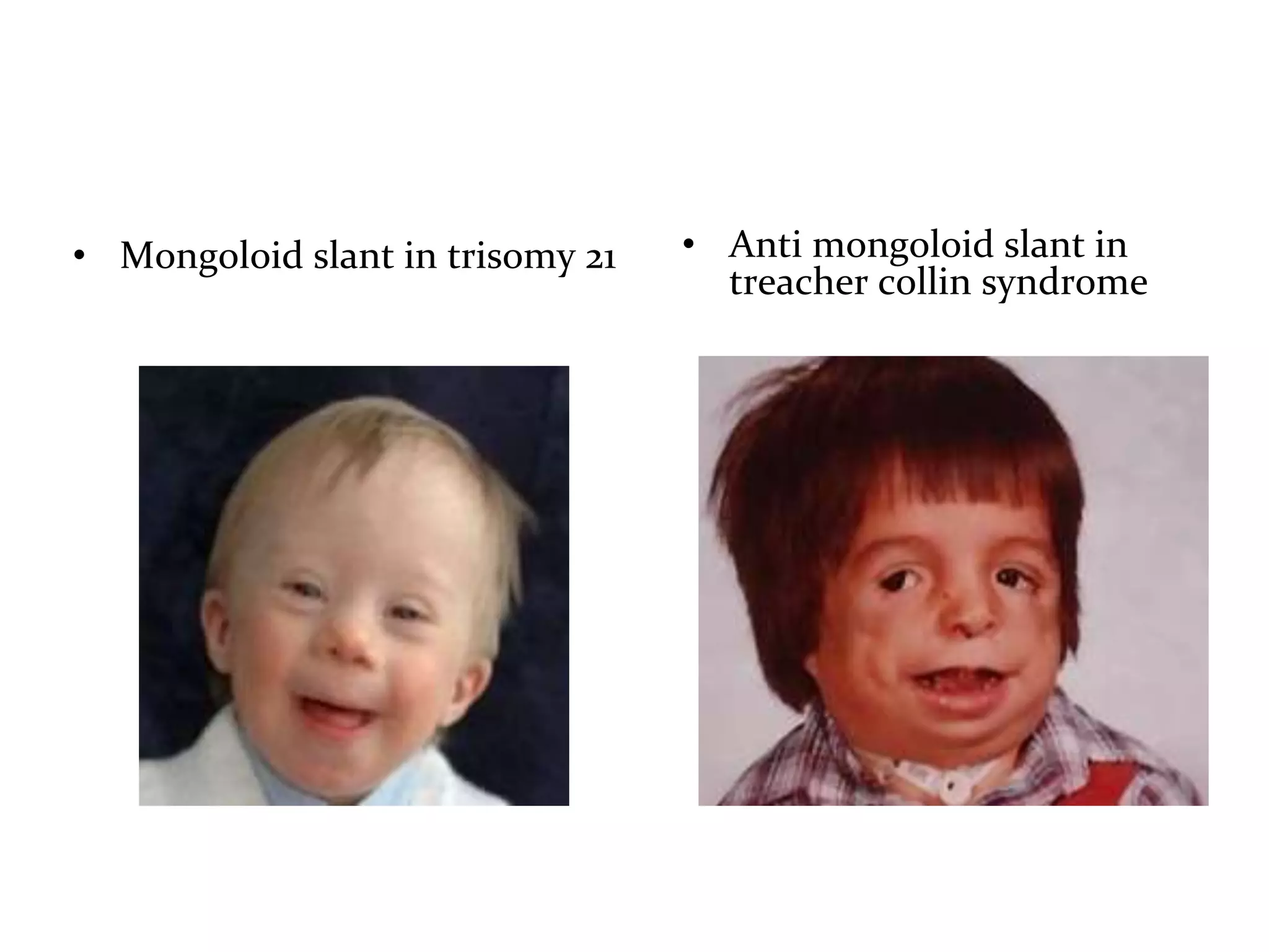 Anatomy of the eyelids | PPTX