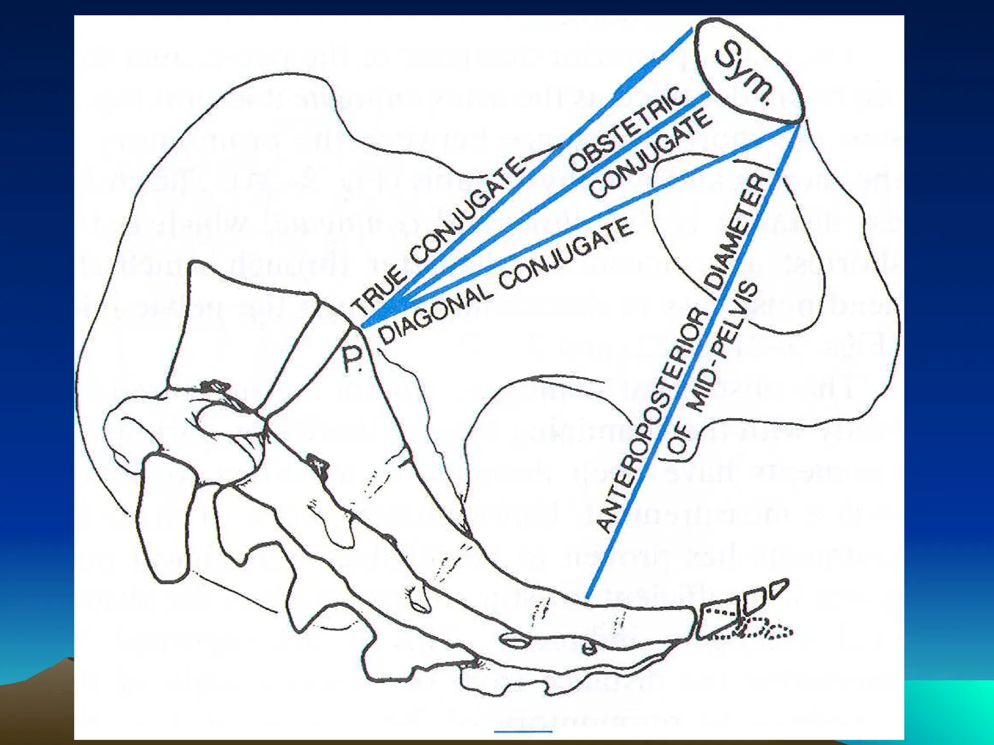 ANATOMY OF THE FEMALE BONY PELVIS and FETAL.ppt