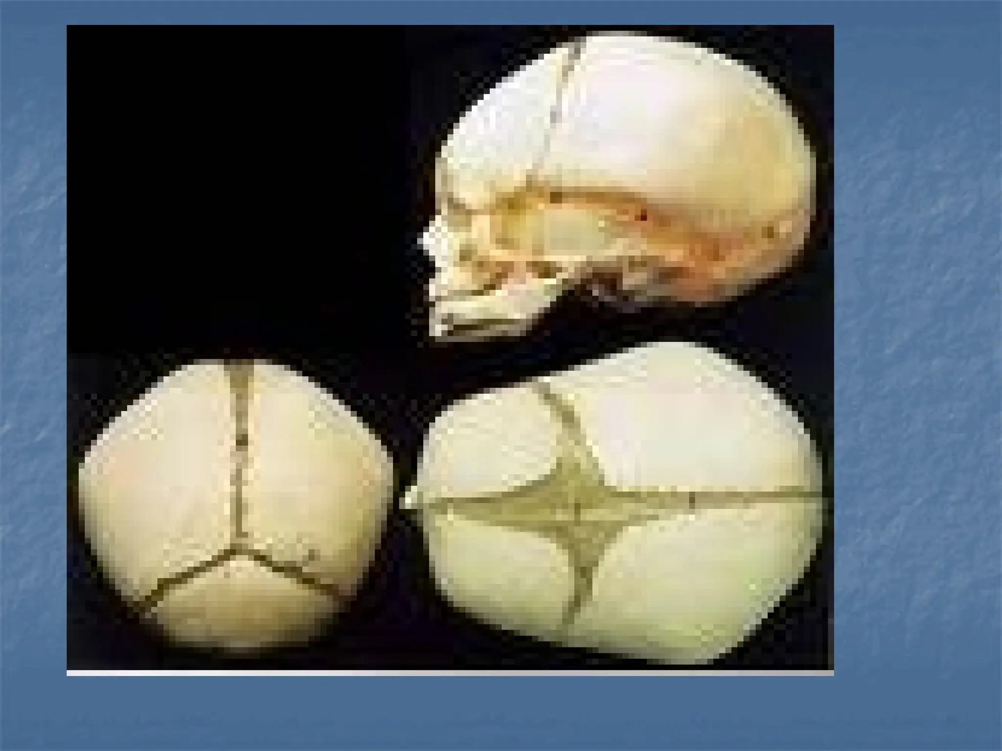 ANATOMY OF THE FEMALE BONY PELVIS and FETAL SKULL.pptx