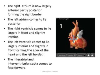 Anatomy of The Heart.pptx