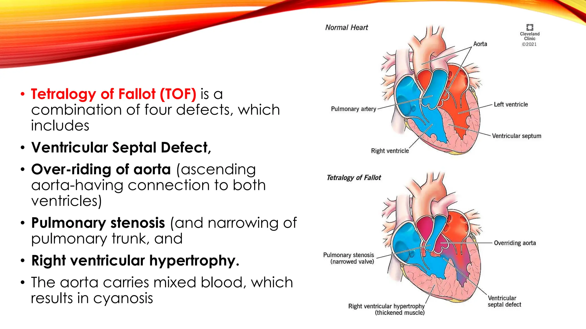 Anatomy of the heart.pdf. Histological . | PPT