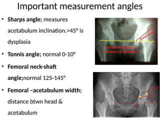 anatomy of the Hip Joint and clinical significance | PPTX