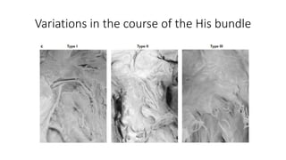 Anatomy of the his bundle | PPTX