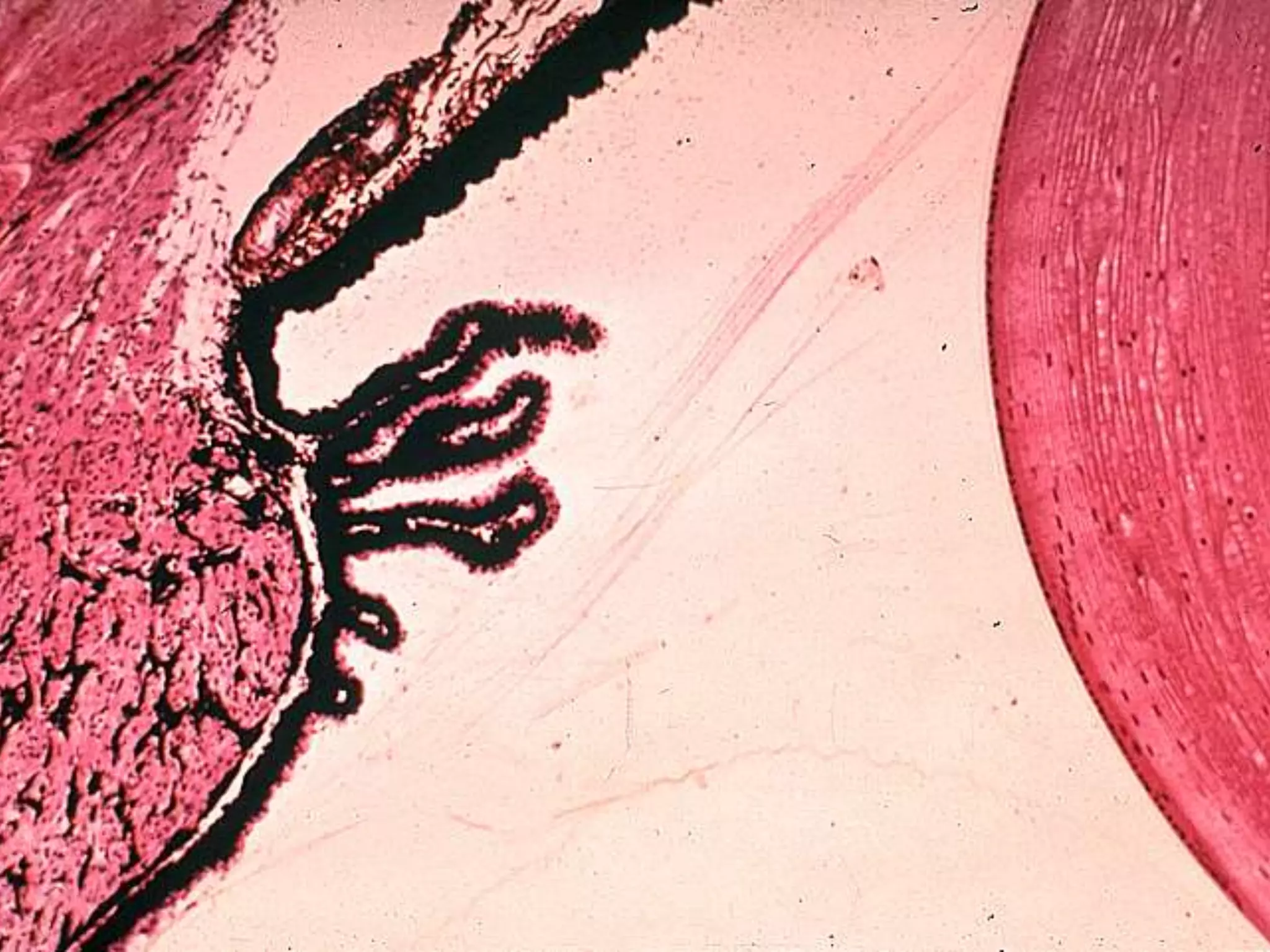 Anatomy of the lens | PPT
