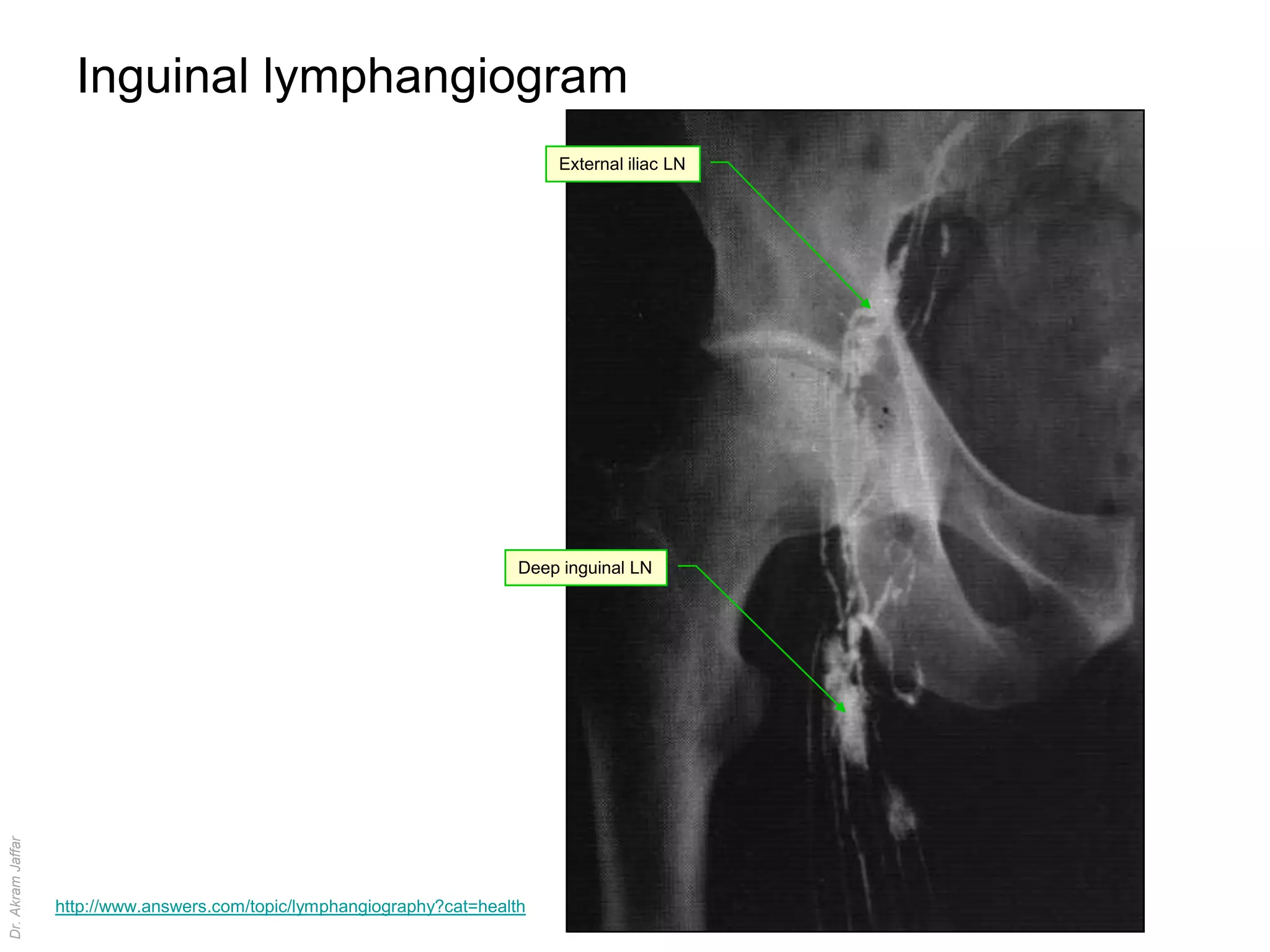 Anatomy of the lymphatic system | PPTX