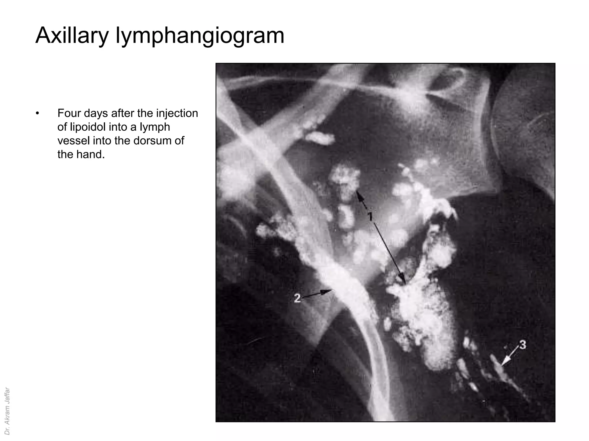 Anatomy of the lymphatic system | PPTX