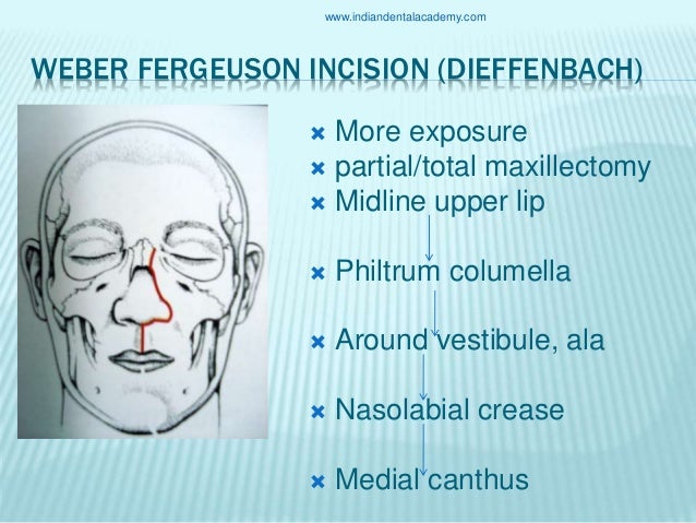 Anatomy of the maxilla and its surgical implications /cosmetic dentis…