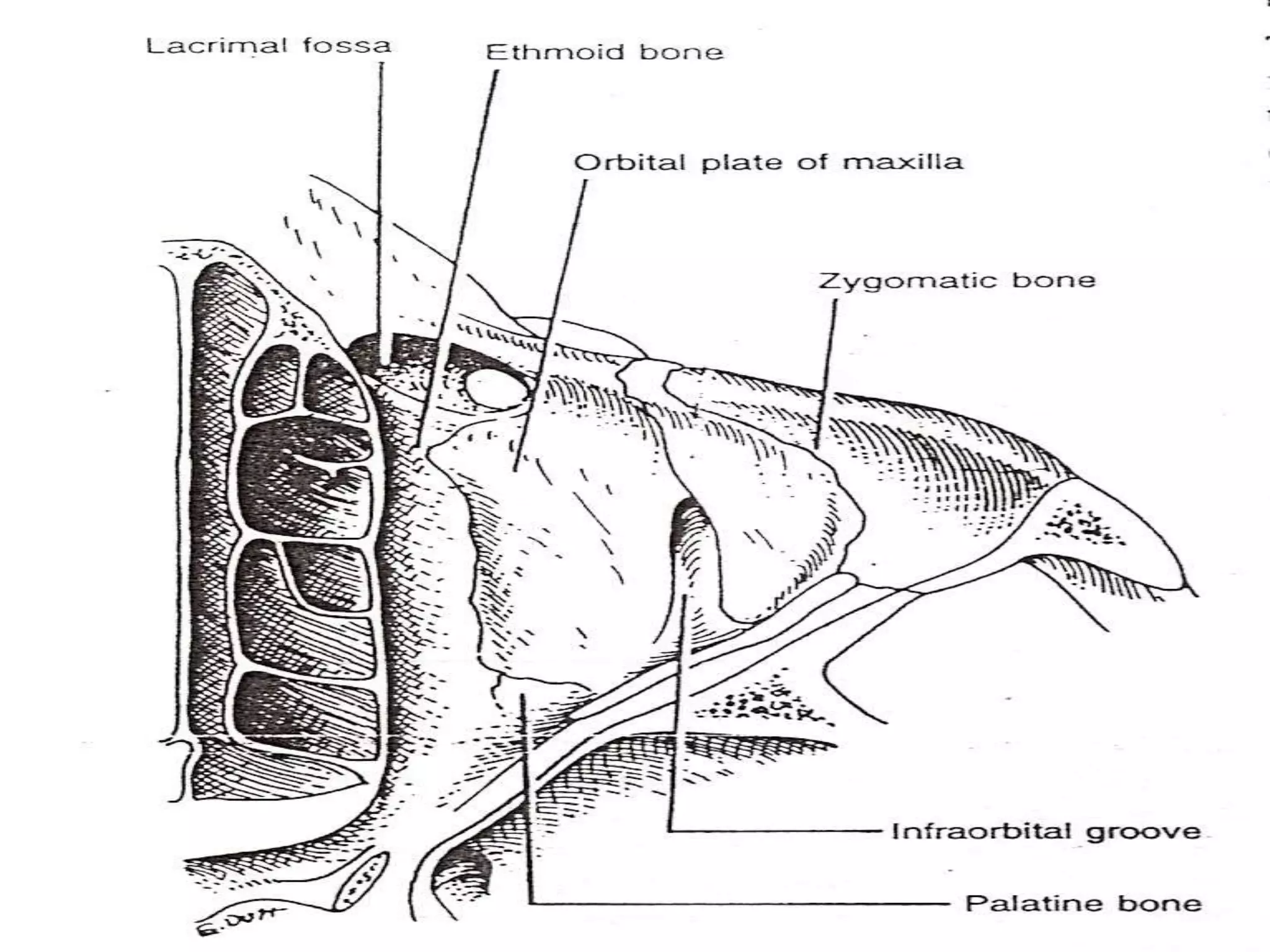 Anatomy and congenital anomalies of orbit | PPT