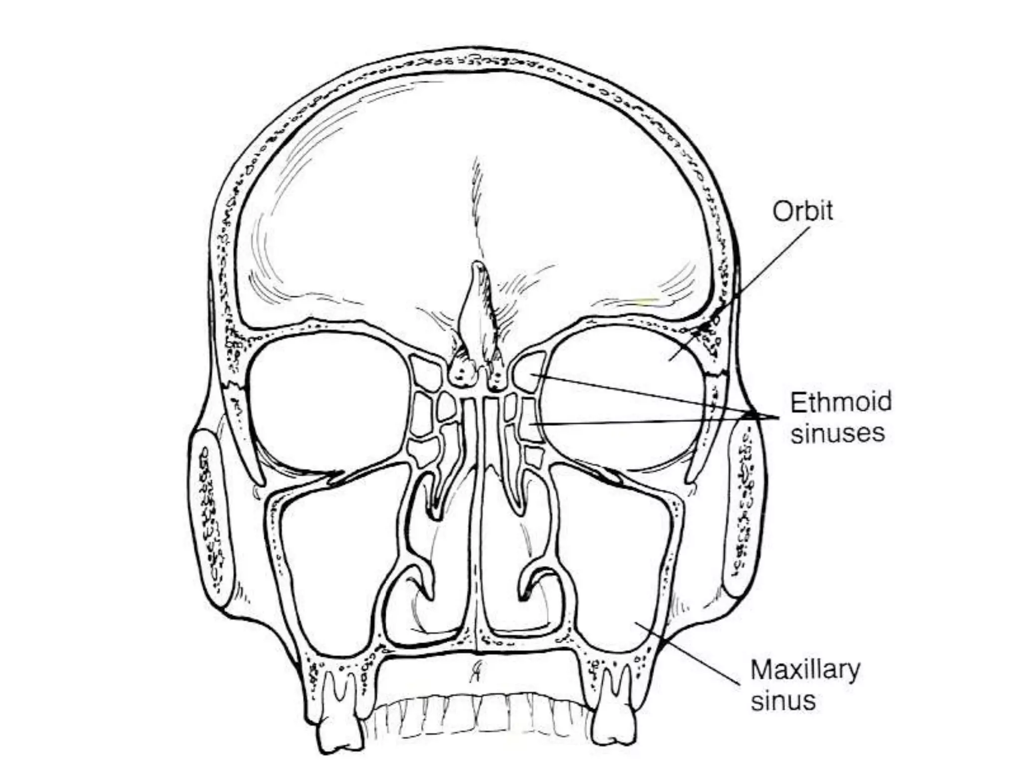 Anatomy and congenital anomalies of orbit | PPT
