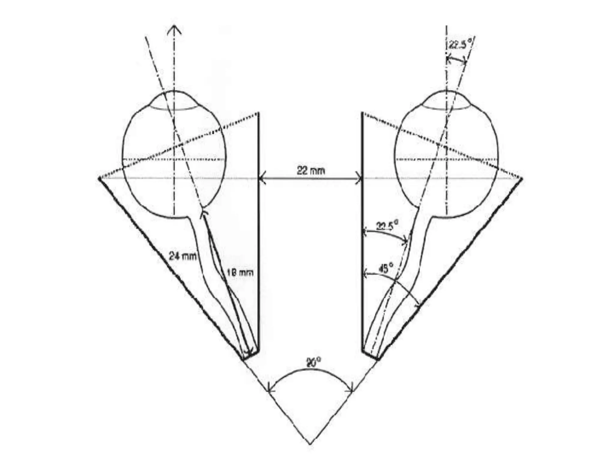 Anatomy and congenital anomalies of orbit | PPT