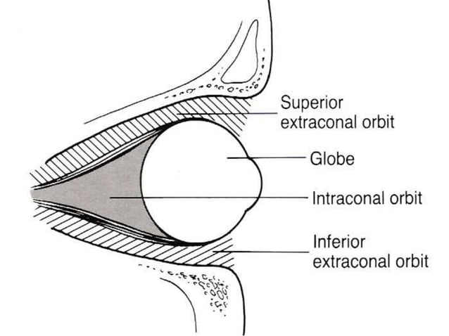 Anatomy and congenital anomalies of orbit | PPT | Ear, Nose and Throat ...