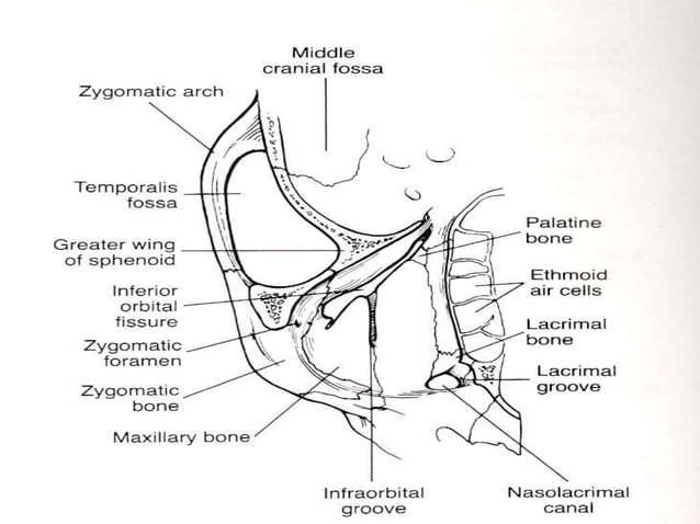 Anatomy and congenital anomalies of orbit | PPT | Ear, Nose and Throat ...