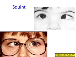 Anatomy of the orbit | PDF