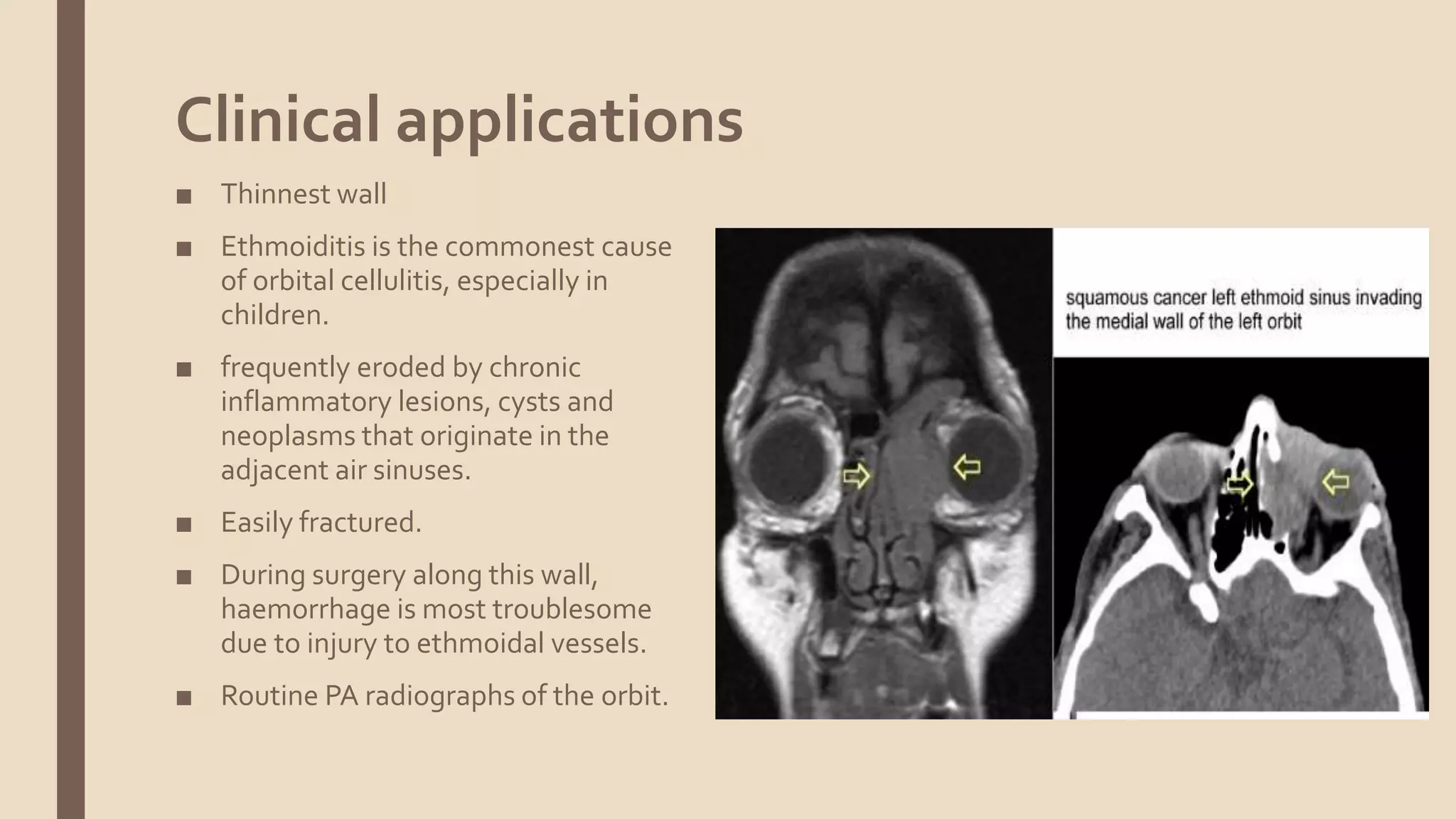 Anatomy of the orbit | PPTX