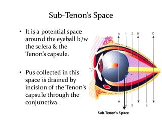Anatomy of the orbit | PPTX