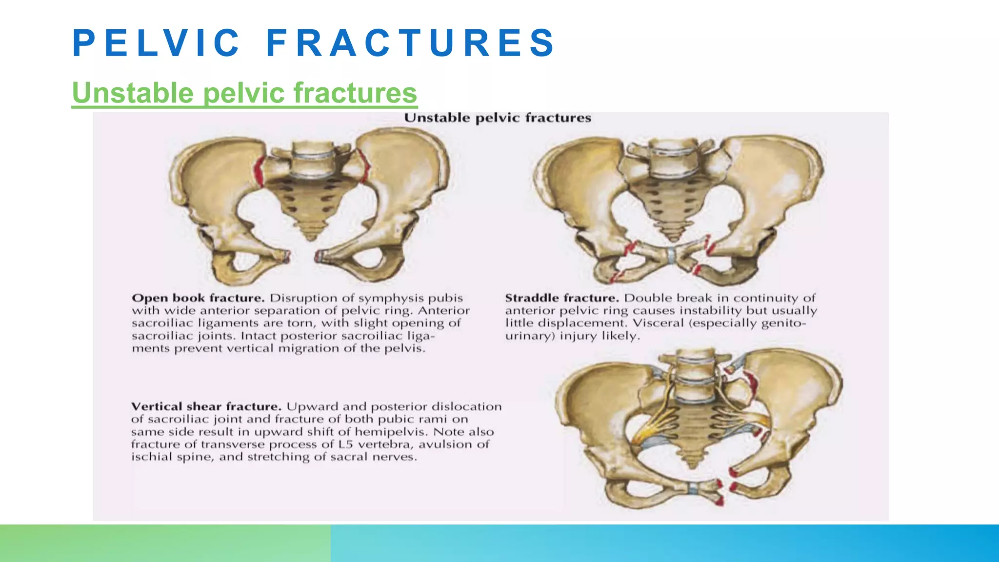 Anatomy of the pelvis (2).pptx