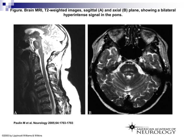 Anatomy of the pons | PPTX