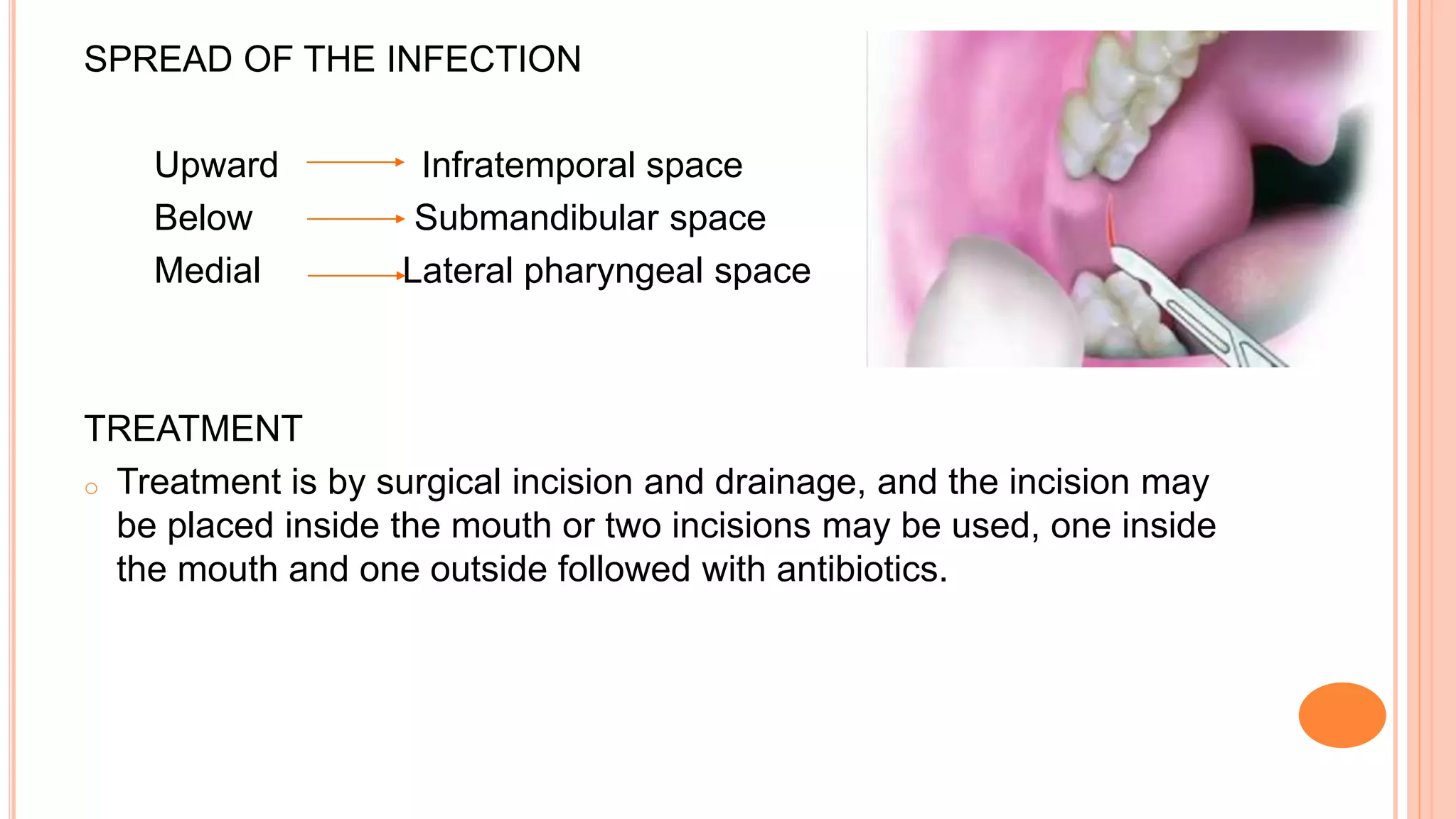 Anatomy of the pterygomandibular space and its clinical significance | PPTX