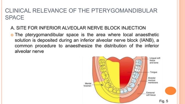 Anatomy of the pterygomandibular space and its clinical significance | PPTX