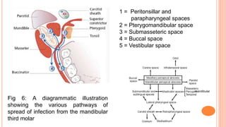 Anatomy of the pterygomandibular space and its clinical significance | PPTX