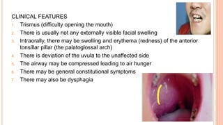 Anatomy of the pterygomandibular space and its clinical significance | PPTX