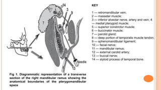Anatomy of the pterygomandibular space and its clinical significance | PPTX