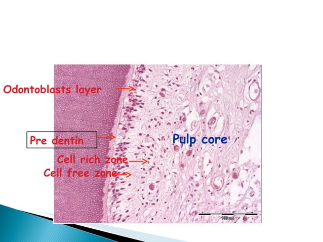 Anatomy of the pulp space | PPT