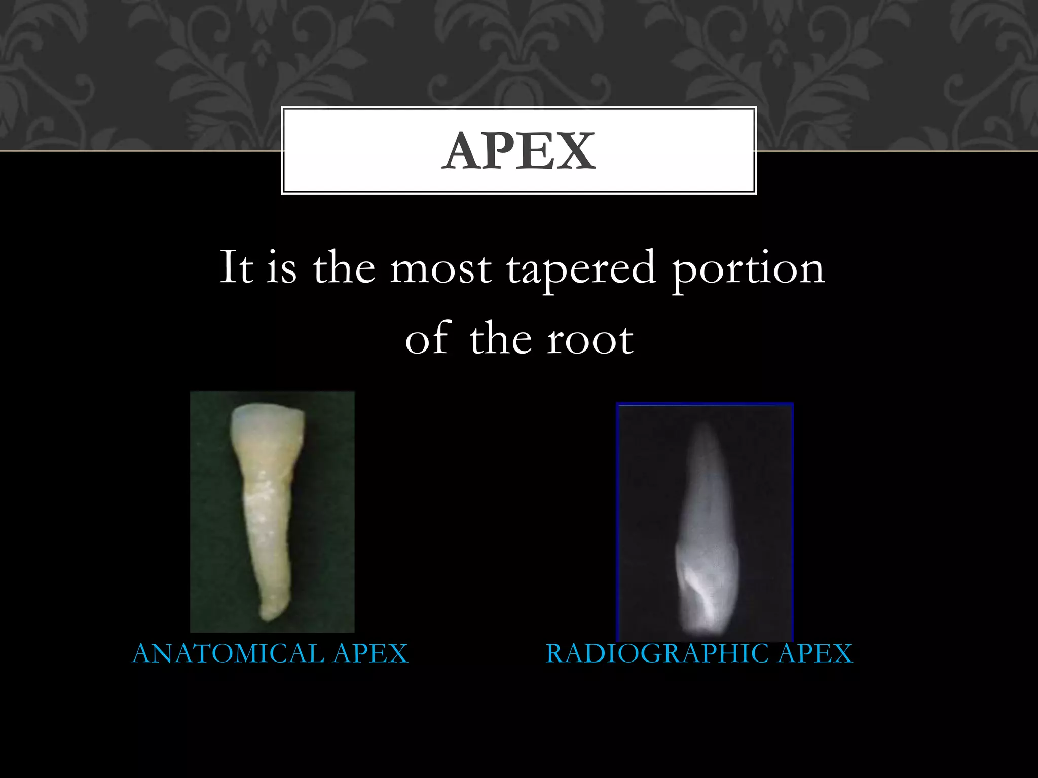 Anatomy of the pulp space and access cavity | PPTX