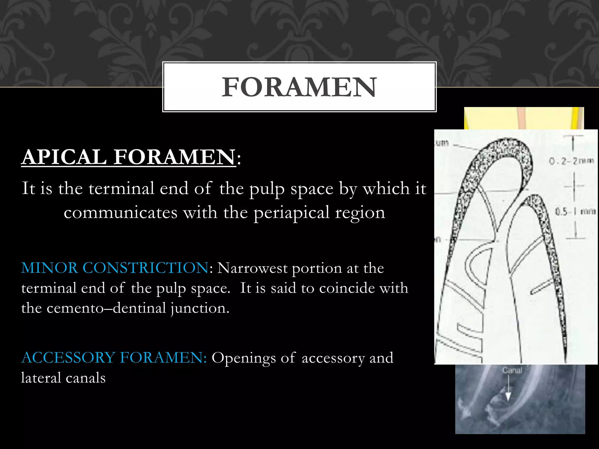 Anatomy of the pulp space and access cavity | PPTX